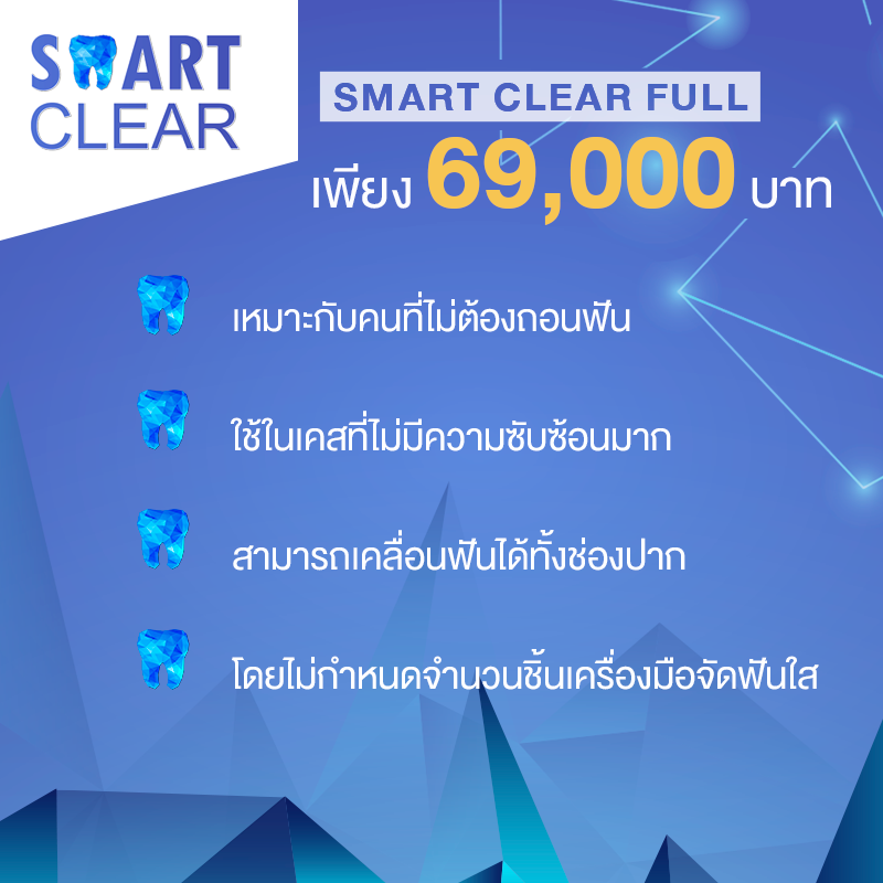 จัดฟันแบบใส จัดฟันแบบใสราคา จัดฟันใส invisalign จัดฟัน invisalign