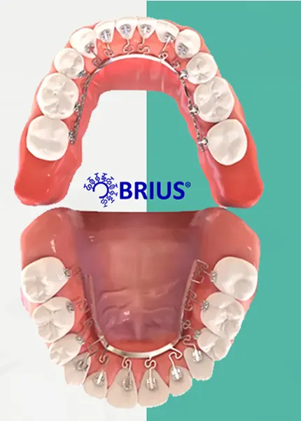 จัดฟันด้านใน Brava By Brius